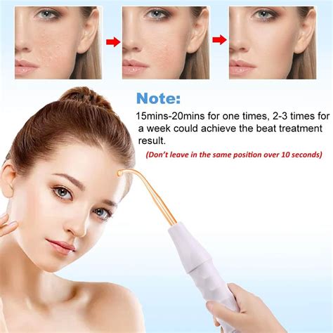 High Frequency Facial Wand Acne And Anti Aging Skincare Device