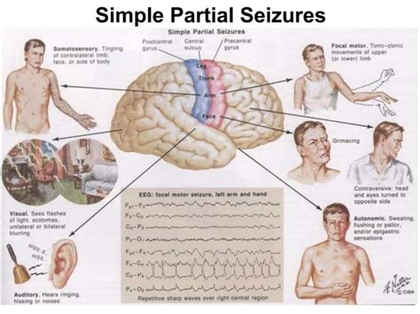 Diagrams Eeg Epilepsyppt Brain And Nervous System Disorders