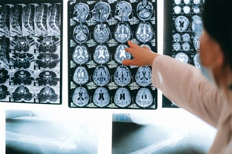 PERBEDAAN FMRI DAN MRI YANG HARUS ANDA TAHU AGM MEDICA