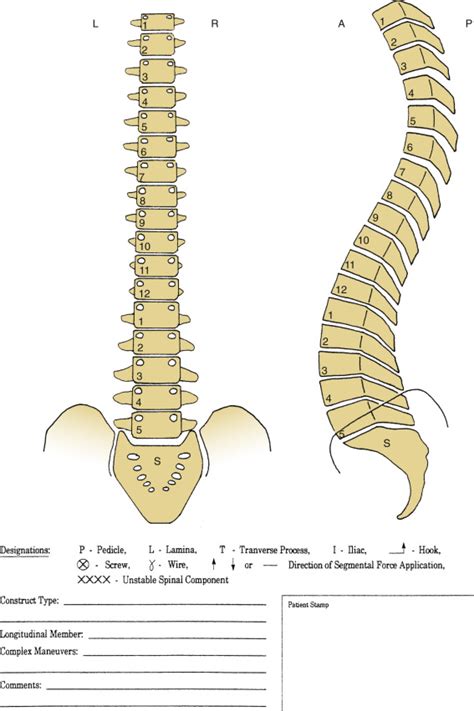 Thoracic And Lumbar Spine Construct Design Neupsy Key
