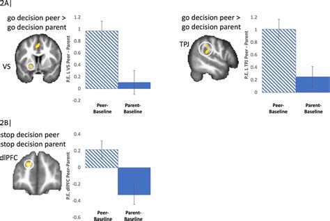 a vs and tpj activity when adolescents took risks go decision in