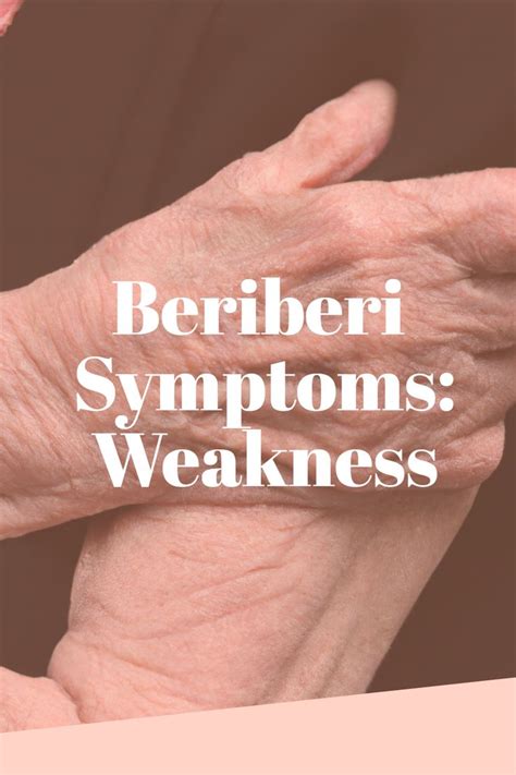 Beriberi Thiamine Deficiency Beriberi Pictures And Images Nursing