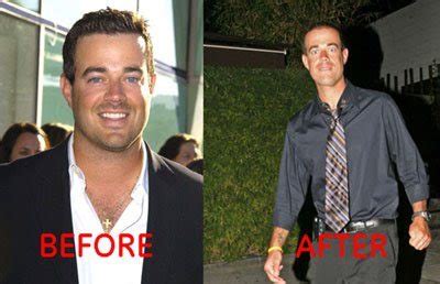 Carson Daly Before And After