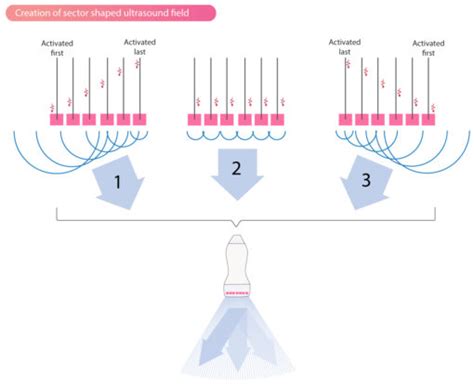 Two Dimensional 2d Echocardiography