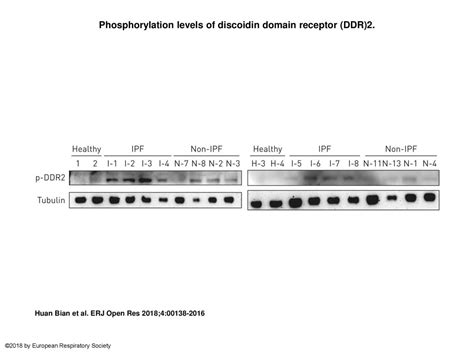 phosphorylation levels of discoidin domain receptor ddr 2 ppt download