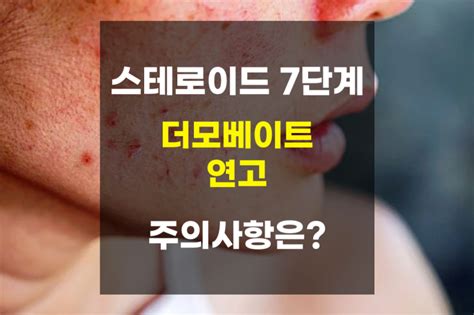 더모베이트연고 15g 10g 스테로이드 최고 등급의 주의사항은요 네이버 블로그