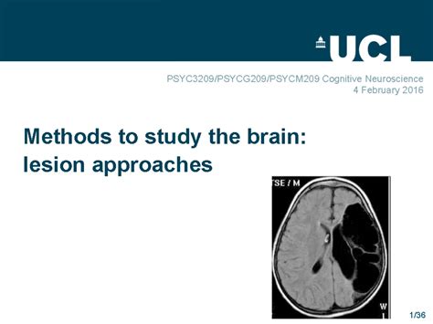 Lecture Notes Lectures 4 6 Cognitive Neuroscience Cognitive Neuroscience 4 February 2016
