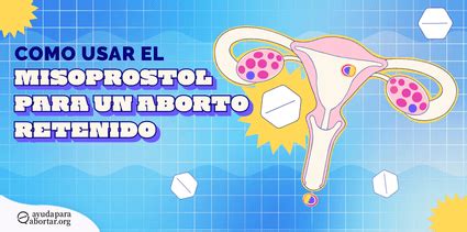 Cómo Usar El Misoprostol Para Un Aborto Retenido Y Cuáles Son Los