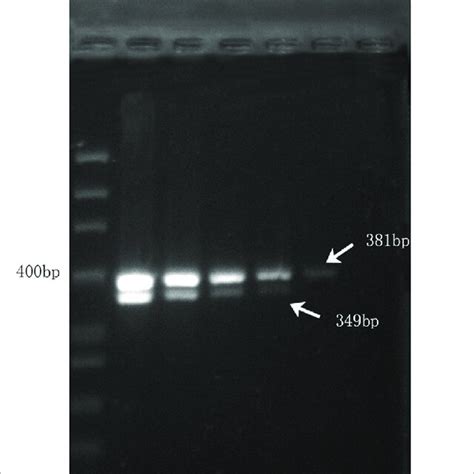 Sensitivity Analysis Of The Multiplex Pcr Assay With Different