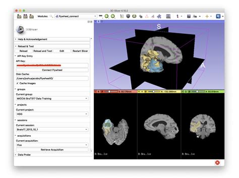 Flywheel Connect 3d Slicer Extension • Flywheel