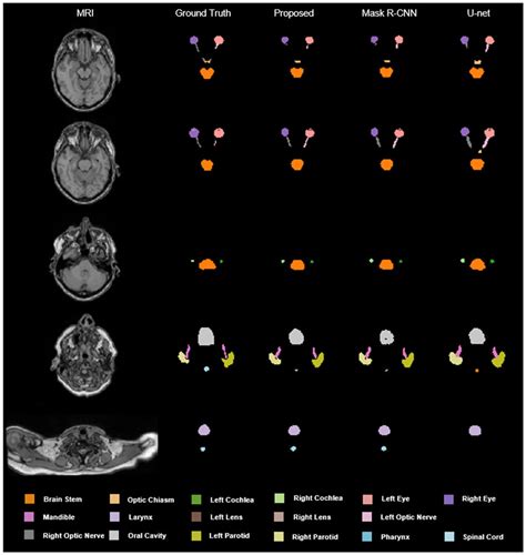 Illustrative Example Of The Segmentation Achieved By Our Proposed Download Scientific Diagram