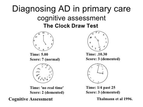 Clock Drawing Test Vascular Dementia At Humberto Vernon Blog