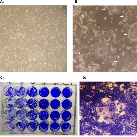 The Cytopathic Effect Cpe And Plaque Development Caused By Oncolytic