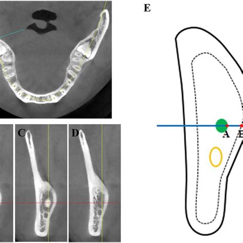 Morphology Of Lingual Plate At The Level Of Root Apex Identified On Download Scientific Diagram