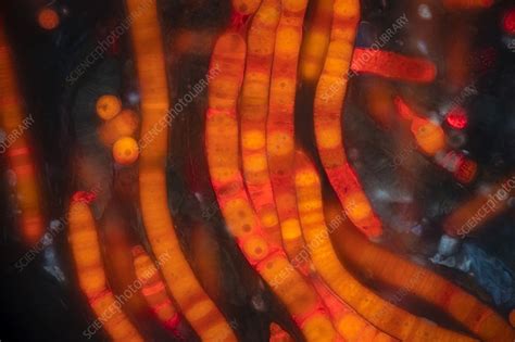 Lyngbya Sp Algae Light Micrograph Stock Image C056 3028 Science Photo Library
