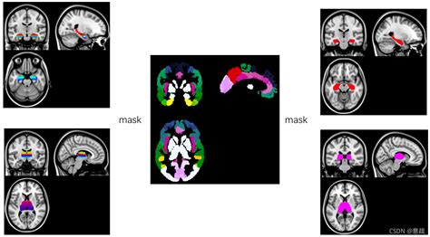 mri脑影像分析——根据脑图谱获取感兴趣区域mask，以海马体与丘脑为例 matlab nilearn nibabel rest1 8） 意疏 开放原子开发者工作坊