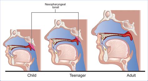 Velopharyngeal Nasal Function And Speech Production Ento Key