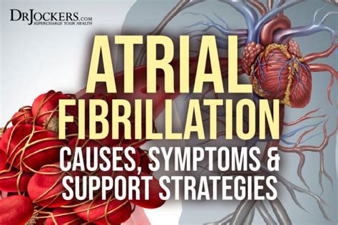 Atrial Fibrillation Causes Symptoms Natural Support Strategies Artofit
