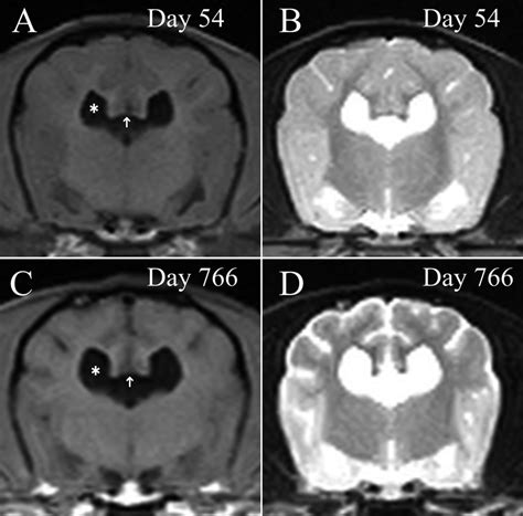 Transverse Images At The Level Of The Diencephalon Note The Absence Of Download Scientific