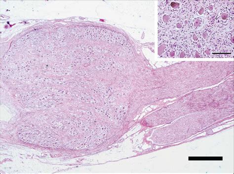 Sensory Neuron Histology