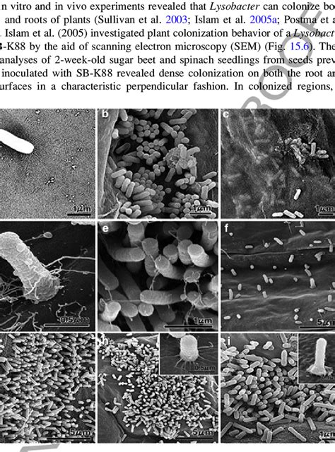 6 Tem A And Sem B I Micrographs Illustrating The Morphology Of