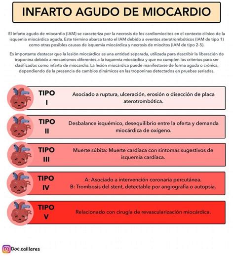 Tipos De Infarto Dr Boris Moises Caillares Montaño Udocz