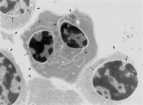 Eritroblastos Con Doble Membrana Citoplásmica
