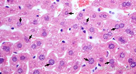 核仁的结构和成分 知乎