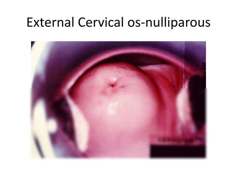 Solution Anatomy Of Cervix Studypool