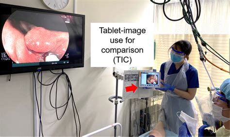 The Tabletimage Comparison TIC Images Obtained Via The First Download Scientific Diagram