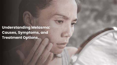 Understanding Melasma Causes Symptoms And Treatment Options