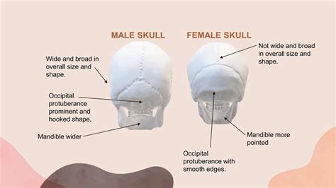 Sex Determination Through Human Skull Pptx Bone And Joint Conditions Diseases And Conditions
