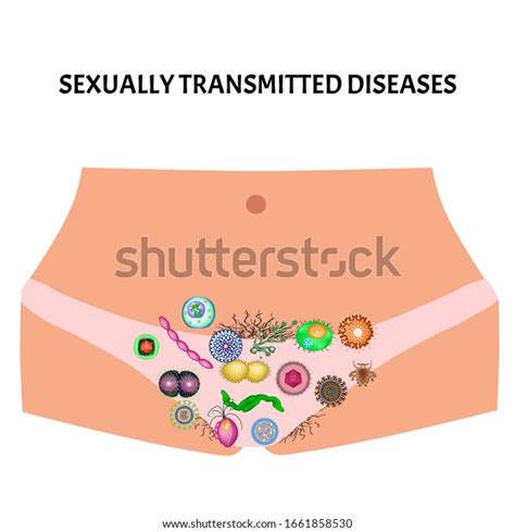 Viral Bacterial Infections Sexually Transmitted Diseases Stock Vector
