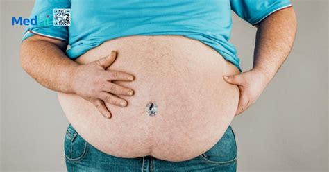 Những Nguyên Nhân Gây Béo Phì Mà Bạn Cần Biết Phòng Khám Medfit