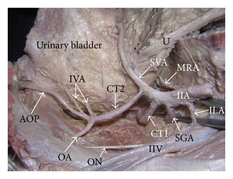 Superior View Of The Left Hemipelvis Aop Artery Of Penis Ct1 Download Scientific Diagram