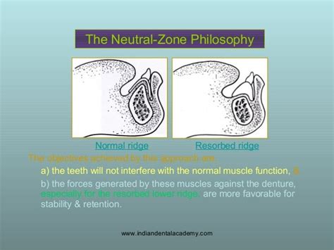 Concept Of Neutral Zone Dental Seminars