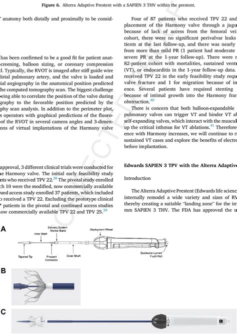 A Schematic Diagram Showing The Alterra Prestent Delivery System