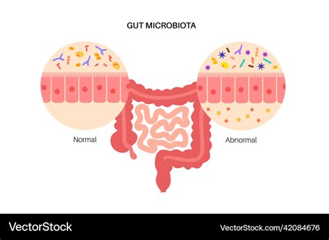Human Gut Microbiota