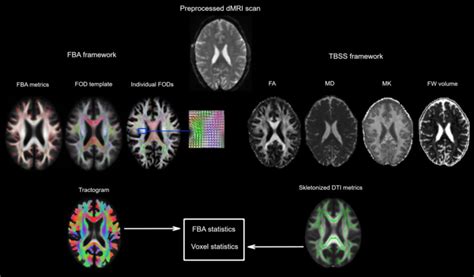 Overview Of Key Processing Steps Of Dmri Scans Preprocessed Dmri Data Download Scientific