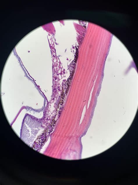 Close Up View Of The Lamellated Layers Of Chitin In A Millipede 400x Magnification R Entomology