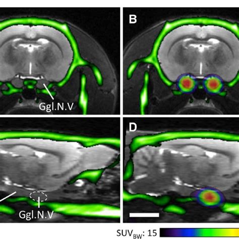 Localization Of Psma In Dorsal Root Ganglia A Transverse Section