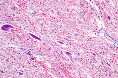 Education Spinal Cord Nerve Cerebellum Cortex And Motor Neuron • Wall Stickers Cortex