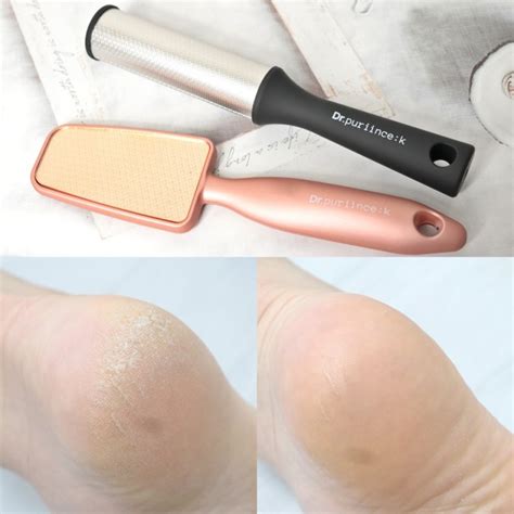 닥터퓨린스케이 발각질제거기 발뒤꿈치 굳은살 각질제거 후기 네이버 블로그