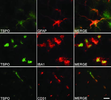 Cell Origin Confirmation Of Tspo Expression In The Hippocampus Of