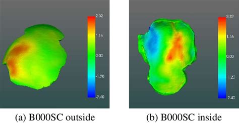 Figure 5 From A Semi Automatic Cranial Implant Design Tool Based On Rigid Icp Template Alignment