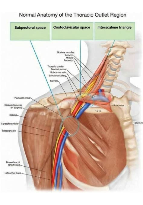 Botulinum Toxin For Thoracic Outlet Syndrome What The Evidence Shows