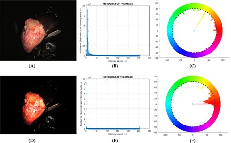 Histogram And Color Variation Of Colon Image By Ifssce Model A Download Scientific Diagram