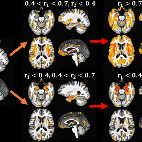 Voxel Wise Statistical Comparison Results Between Selected Subgroups