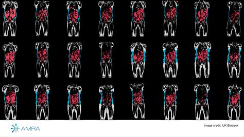 Kaggle Medical Image Dataset
