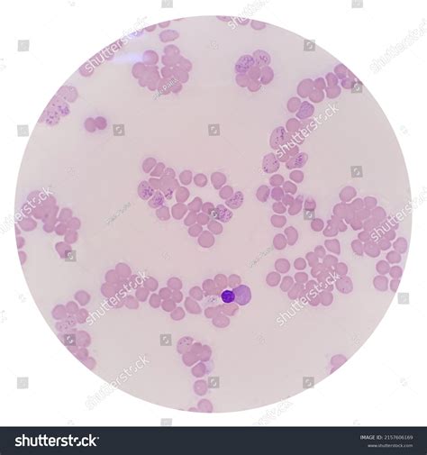 Reticulocyte Stain